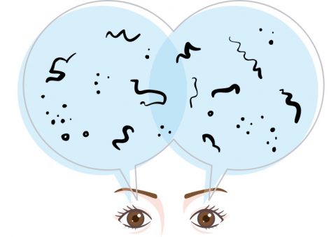 Miodesopsias o cuerpos flotantes | Oftalmologos Consultores